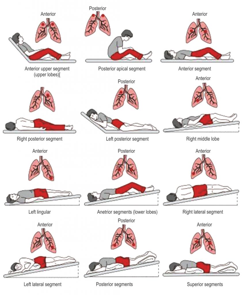 Postural Drainage – Saans Foundation